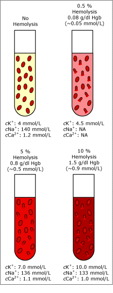 Useful tips to avoid preanalytical errors in blood gas testing ...